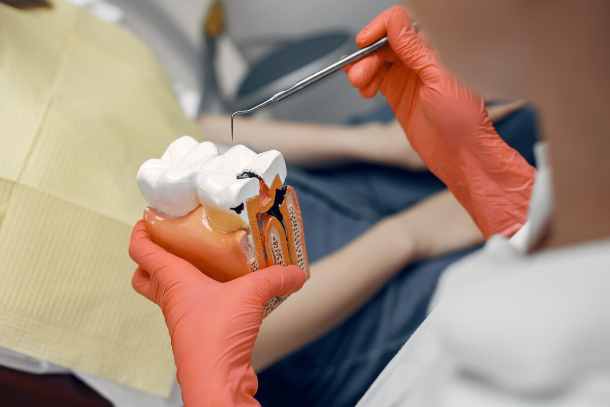 Root Canal Treatment – What to Expect | Northern Dental Gordon